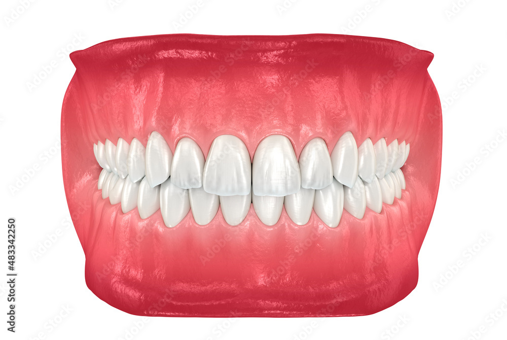 Healthy human teeth with normal occlusion. Medically accurate tooth 3D ...