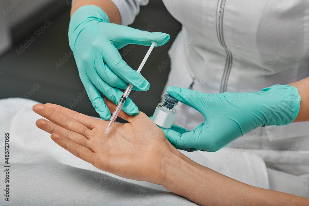 Treatment of palmar hyperhidrosis. Woman's hand during botulinum toxin ...