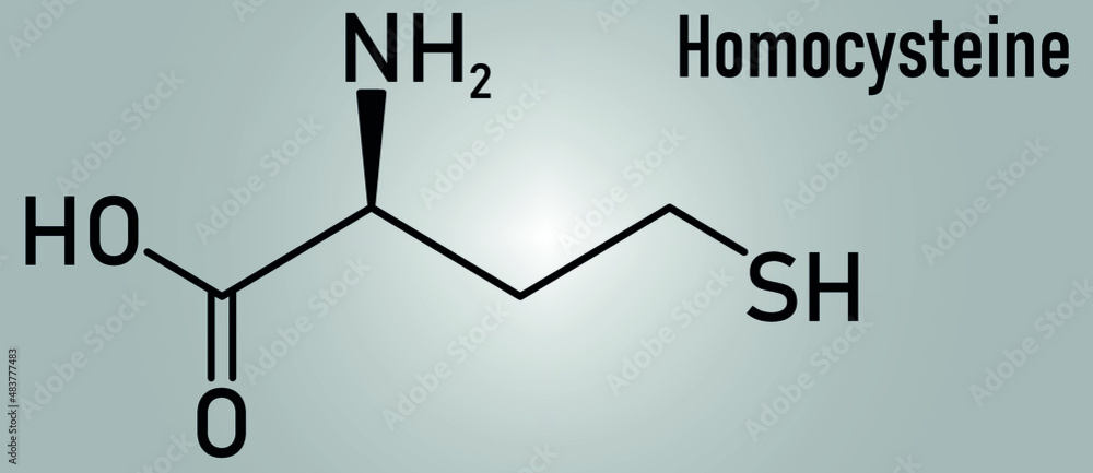 Homocysteine or Hcy biomarker molecule. Increased levels indicate ... Homocysteine or Hcy biomarker molecule. Increased levels indicate ...