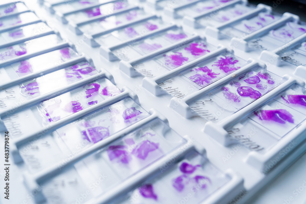 Rows of microscope glass slide in the cells Stock Photo | Adobe Stock