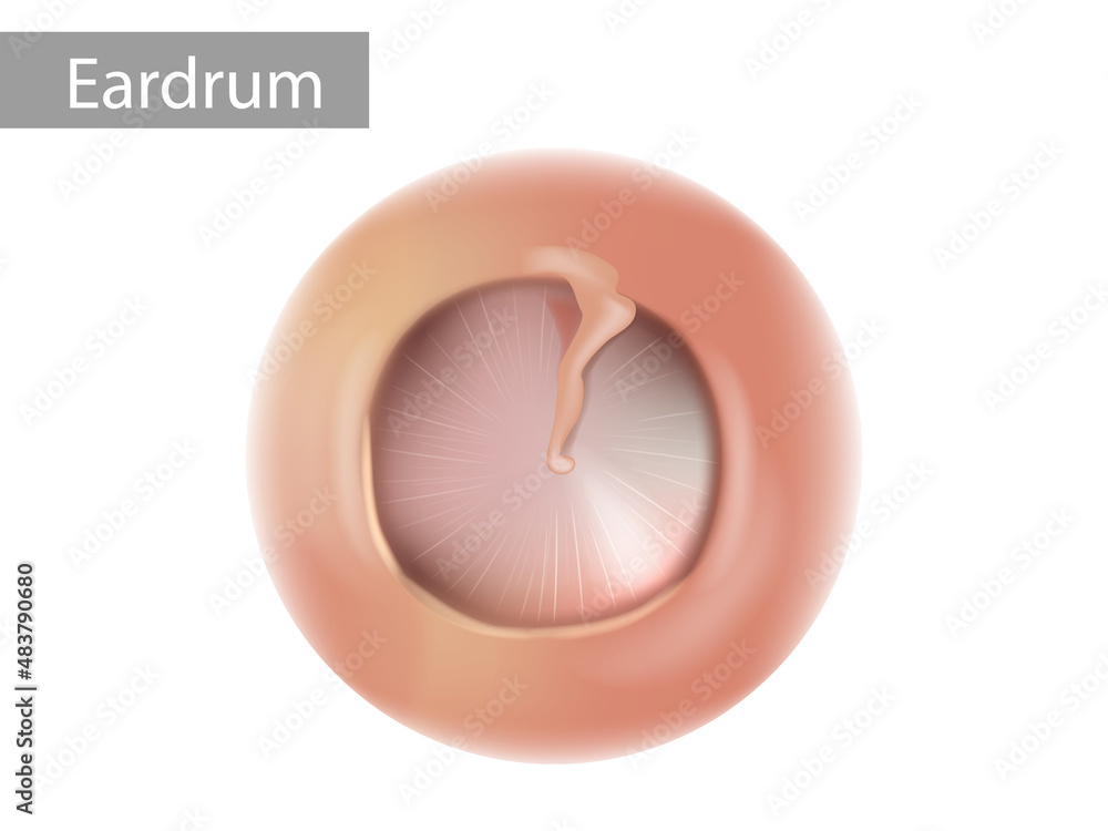 Anatomy of the humans eardrum. Healthy tympanic membrane. Vector Stock ...