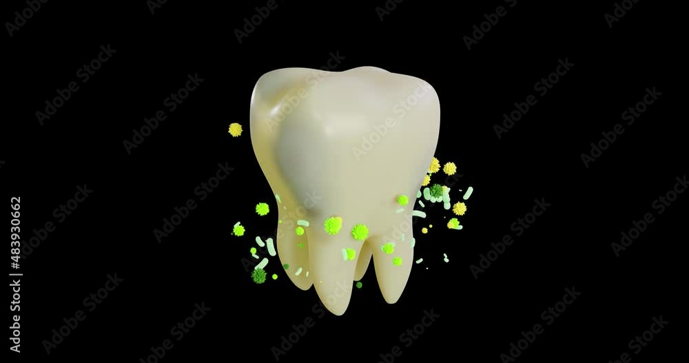 3d animation of darkening of tooth enamel in stages. Attack of bacteria ...
