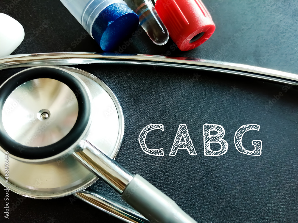 Coronary artery bypass surgery. Coronary Artery Bypass Graft (CABG ...