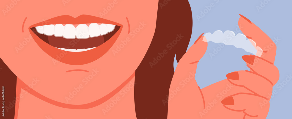Cartoon woman holding invisalign transparent braces with smile ...