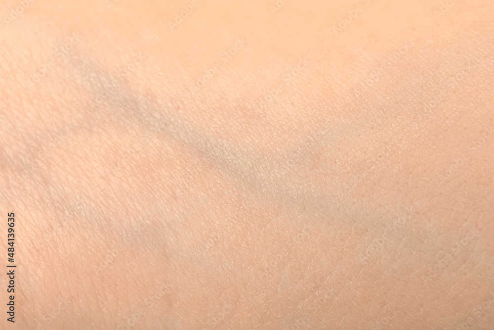 Veiny human skin texture. Detail healthy pink skin background. Young ...