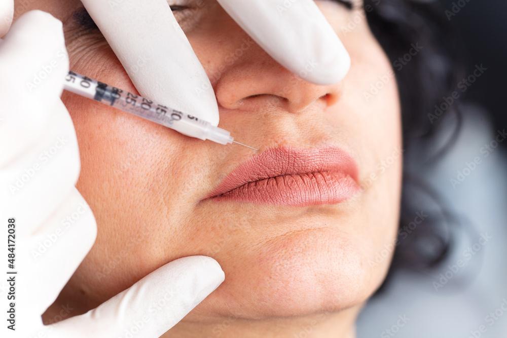 lady getting botox injection for bigger, fuller lips. The woman in the ...