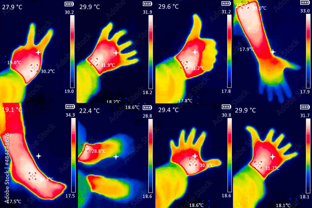 A thermographic image of a person's hand showing different temperatures ...