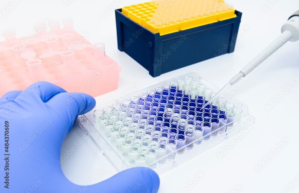Scientist is putting reagents into 96 well micro plate with a single ...