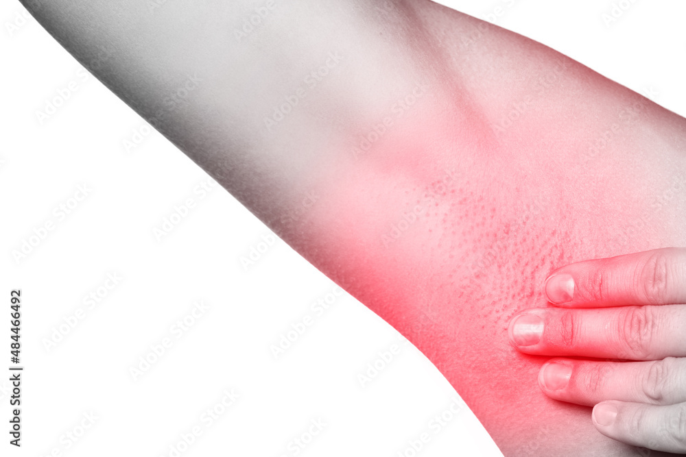 Swollen Lymph Nodes In Armpit Women