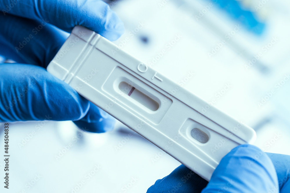 Antigen test antigen coronavirus kit. Laboratory hospital lab ...