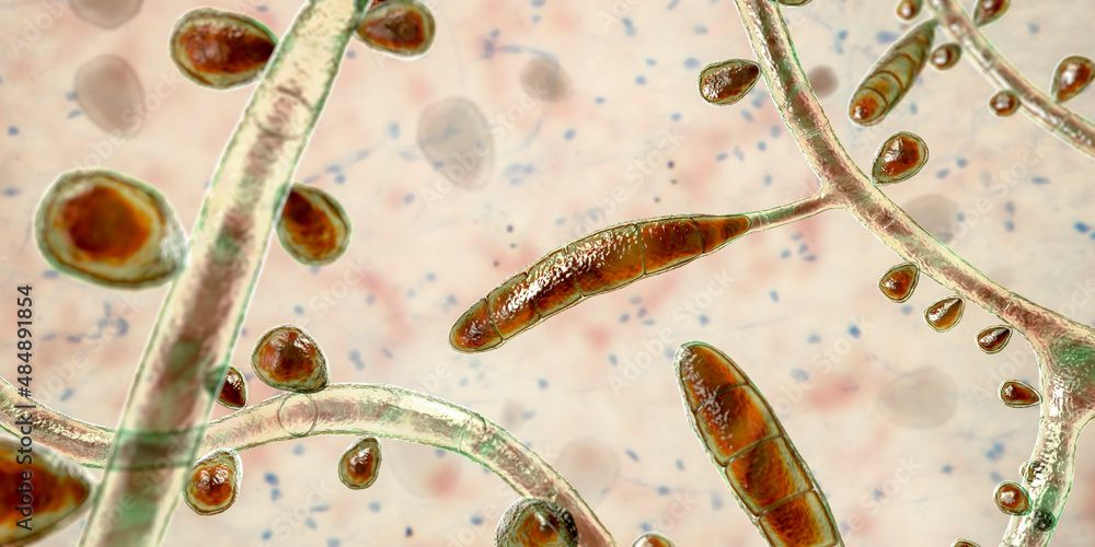 Fungus Trichophyton rubrum, 3D illustration Stock Illustration | Adobe ...