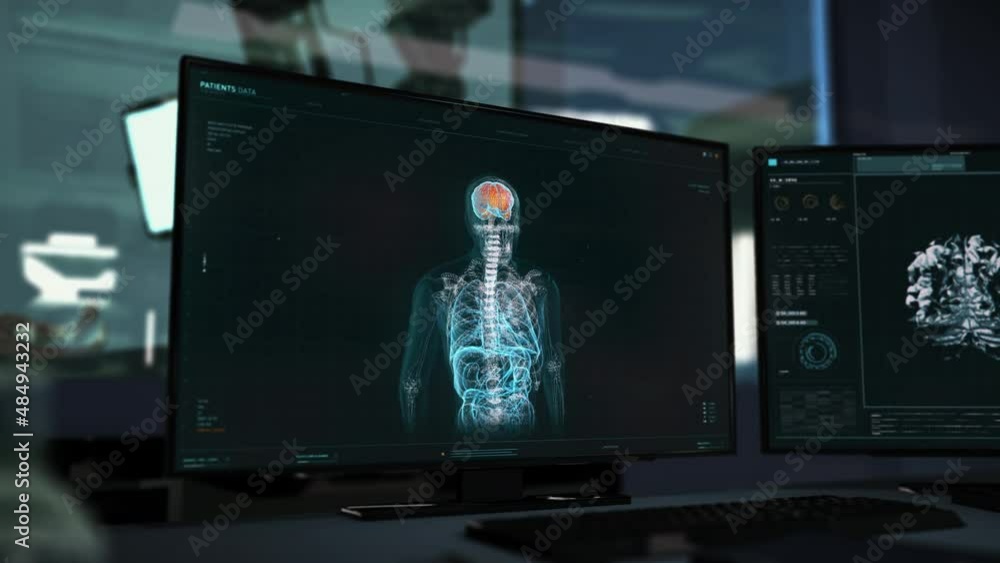 Futuristic interface of an x-ray scanner at the hospital. Futuristic ...