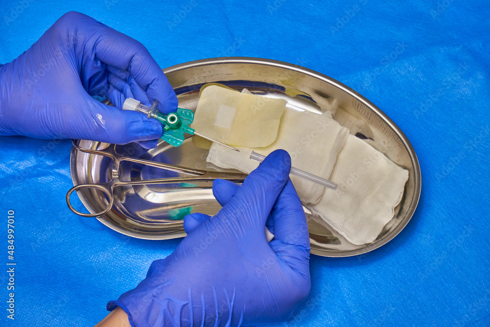 Intravenous infusion. Intravenous catheter in the hands of a doctor ...