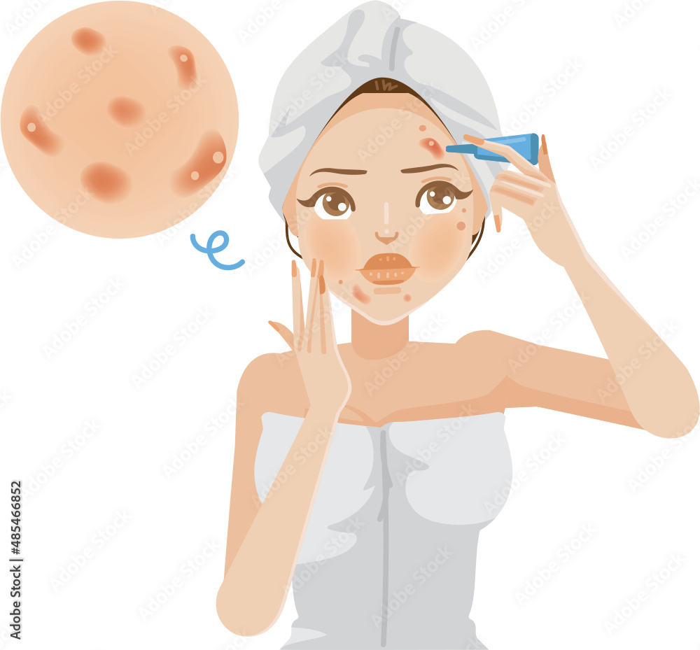 acne treatment female face skin. girl wrapped in towel Stock Vector ...