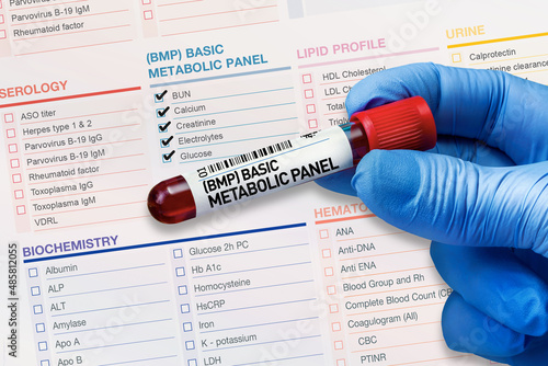 Blood tube test with requisition form for BMP Basic Metabolic Panel ...