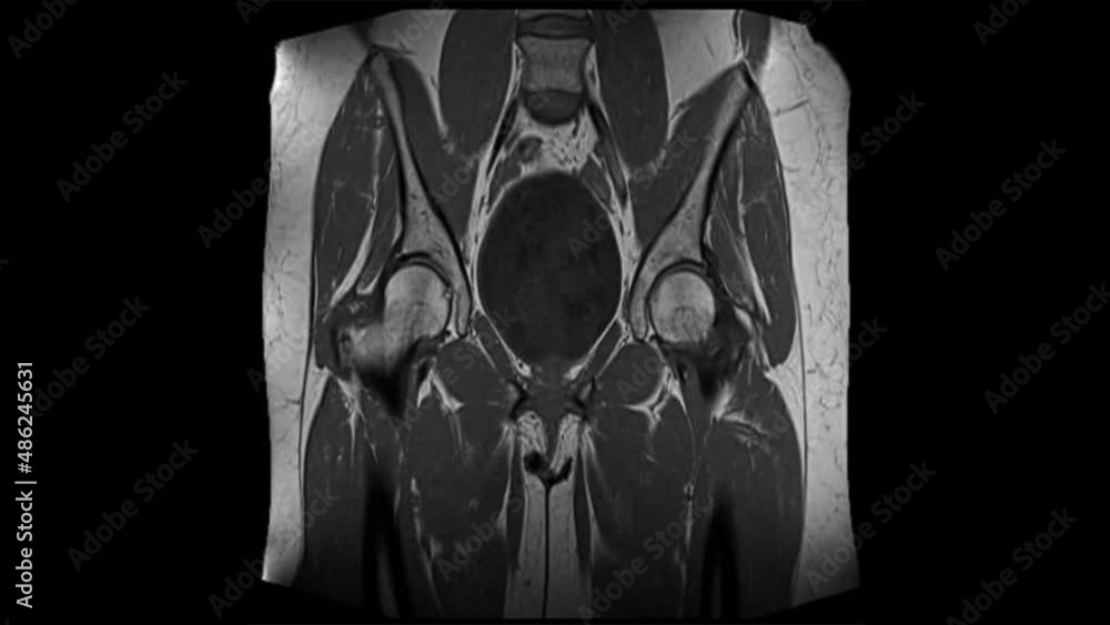 Female Reproductive System The Human Reproductive System X Ray Of The Pelvic Organs Stock