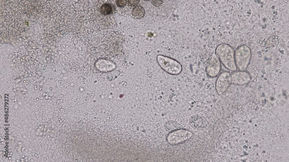 Bacteria and Protozoa in waste water under the microscope. Stock ビデオ ...