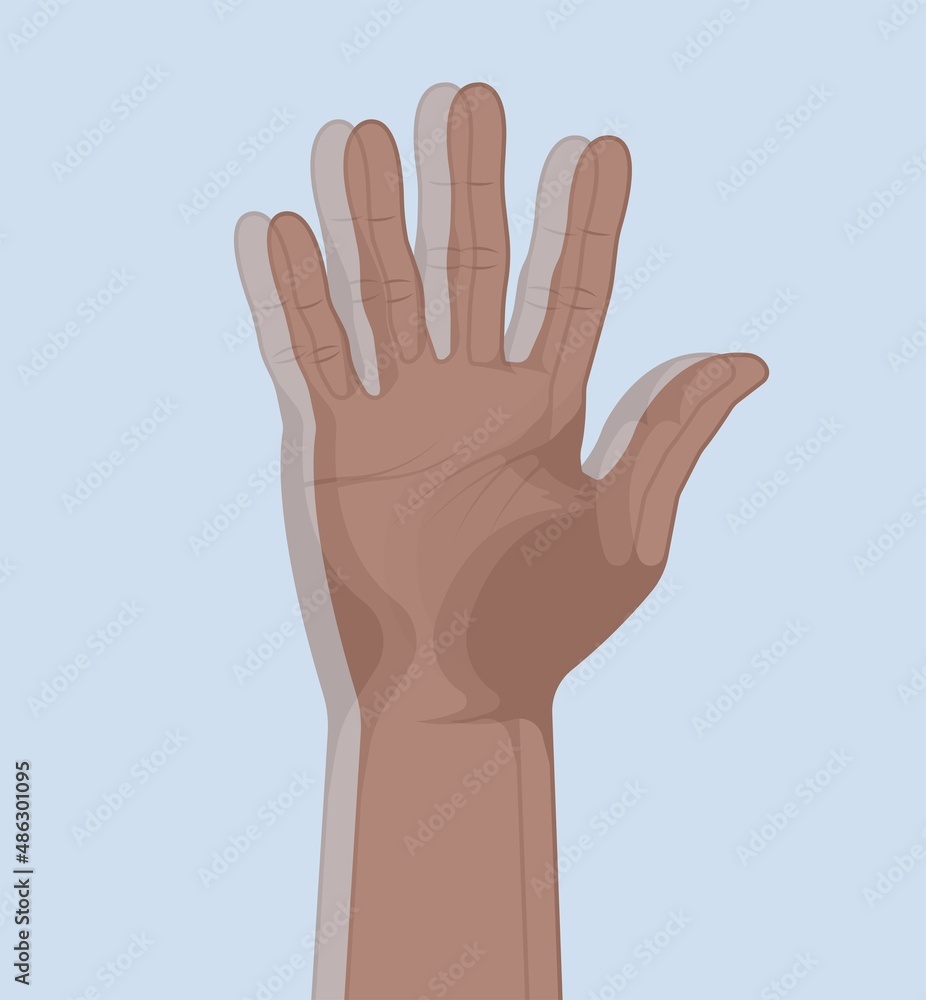 Diplopia double vision test exam brain nerve dry eye palsy gravis ...