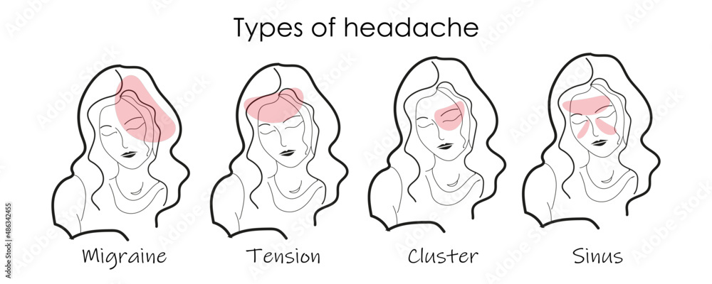 Types of headache illustrated on a woman face, design template for ...