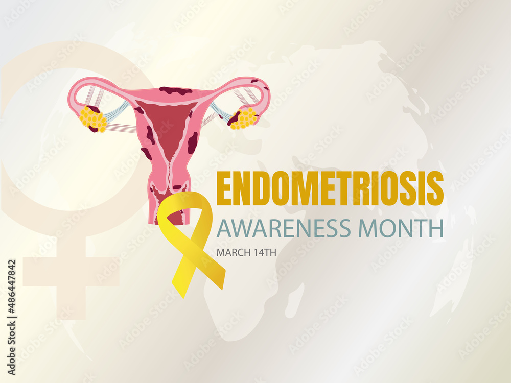 Vectorial illustration of endometriosis awareness.14 March.female reproductive system with signs ...
