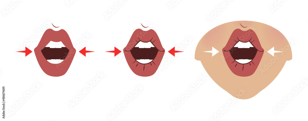Exercises for the expression muscles around the lips and mouth ...