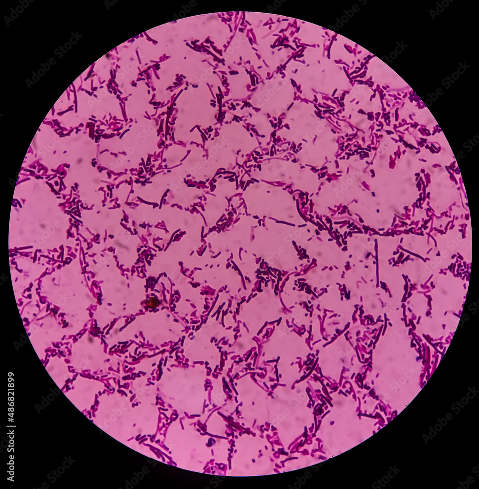 Salmonellosis: microscopic view of gram stained slide from blood agar ...
