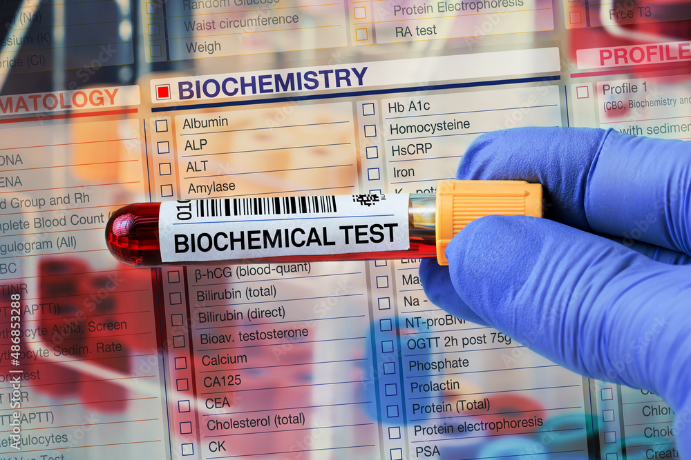Blood tube test with requisition form for Biochemical test. Blood ...