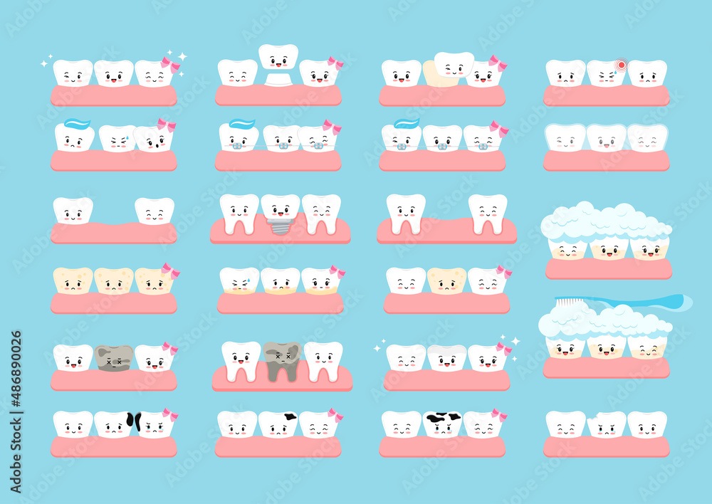 Cute teeth braces, implant, crooked and with tartar veneer in gum ...