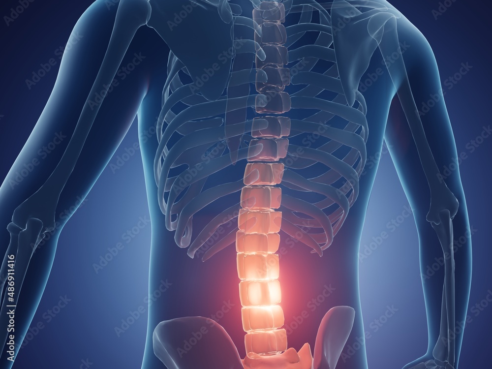 Anatomical illustration of lower back pain Stock Illustration | Adobe Stock