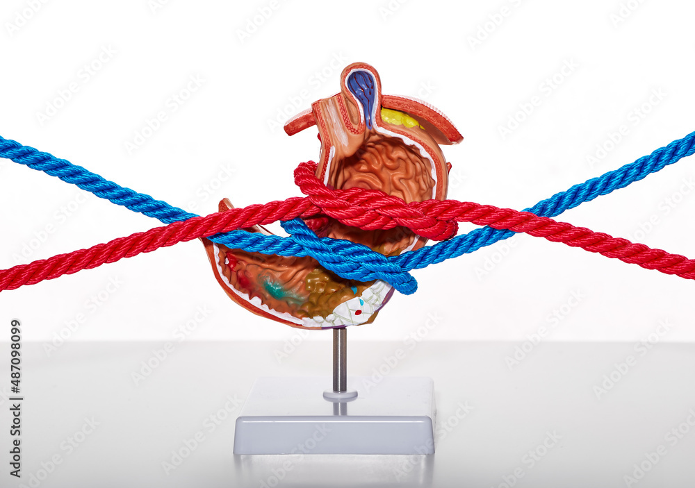 Problems and diseases of human stomach, tight stomach. Anatomical model ...