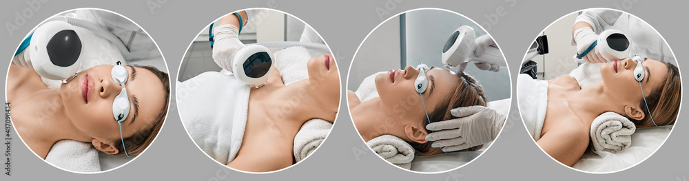 Collage of IPL procedure to remove brown spots, freckles, vascular mesh ...