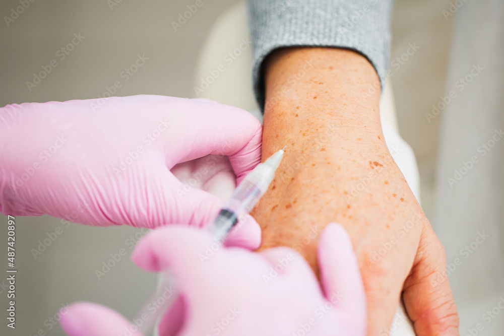 The doctor makes an injection of Botox filler into the arm of the ...