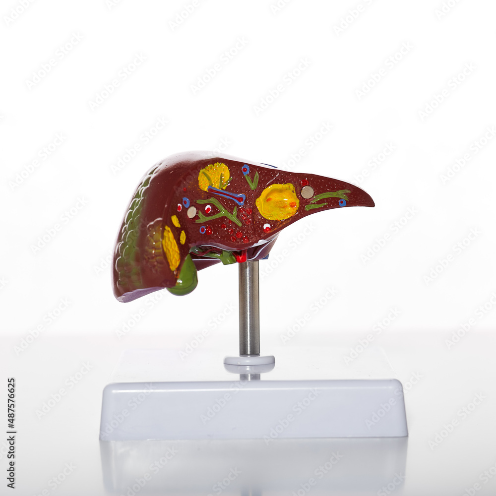 Visual anatomical model of human liver showing liver pathologies and ...