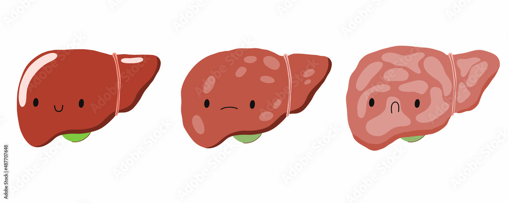 Vektorová grafika „Liver disease. Sick and healthy liver character ...