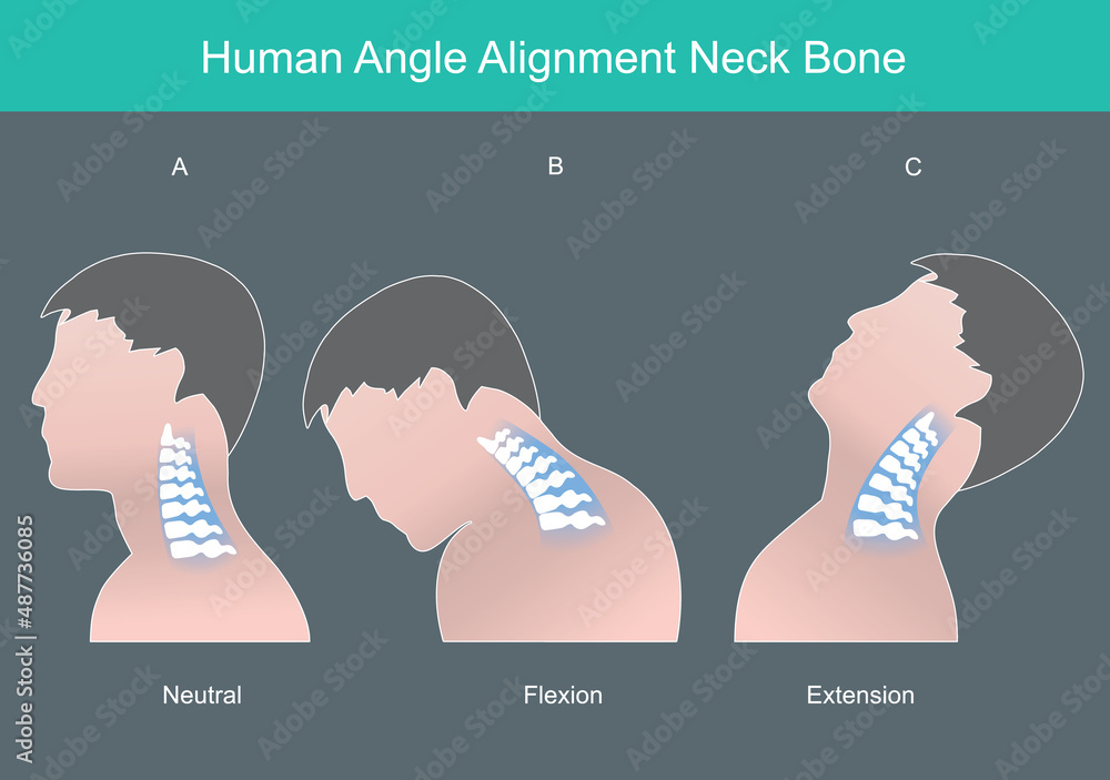 Human angle alignment neck bone. Human neck bone in correct angles ...