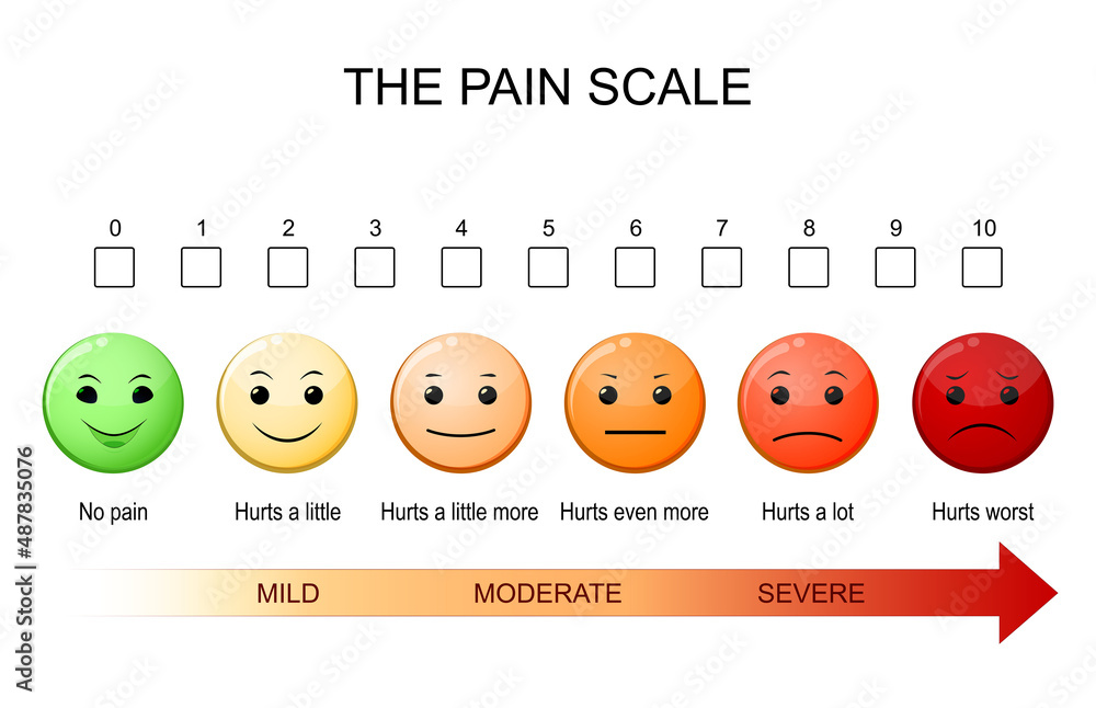 pain scale diagram measures a patient's pain Stock Vector | Adobe Stock