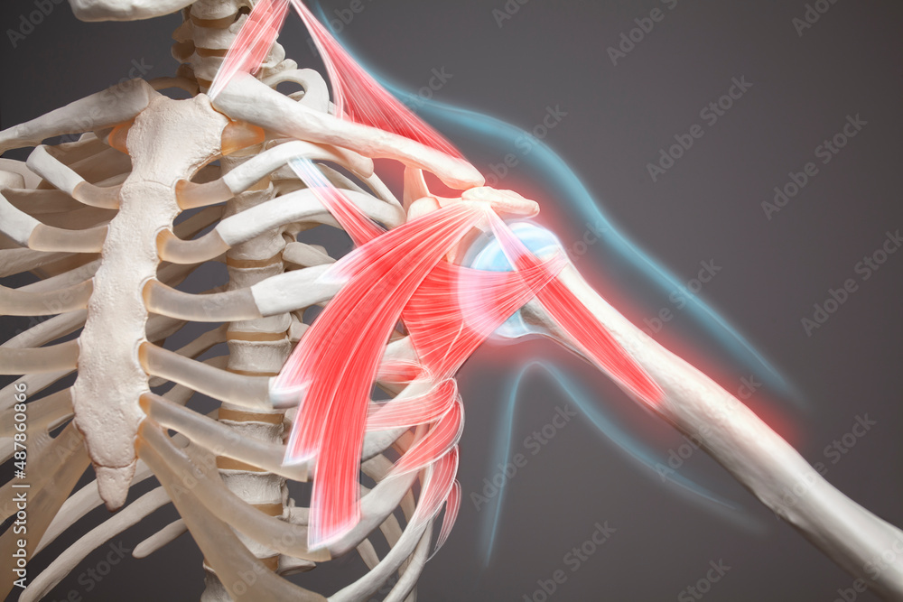 Shoulder pain neuralgia, human skeleton anatomy illustration Stock ...