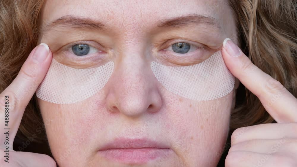 middle aged female's eye with drooping eyelid with patch for eyes ...