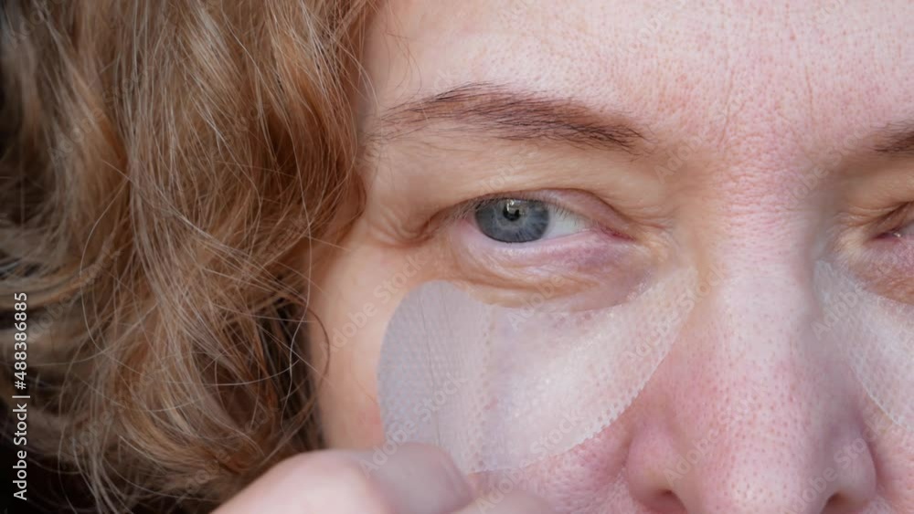 middle aged female's eye with drooping eyelid with patch for eyes ...