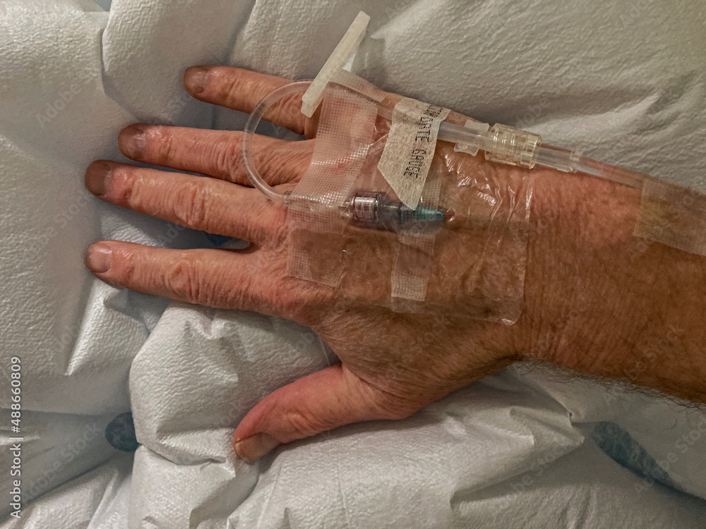 A peripheral intravenous catheter in a male hand. Can deliver medicine ...