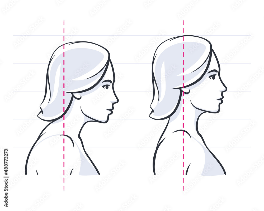 Posture correction. Neck position. Good, right or bad, wrong, incorrect ...