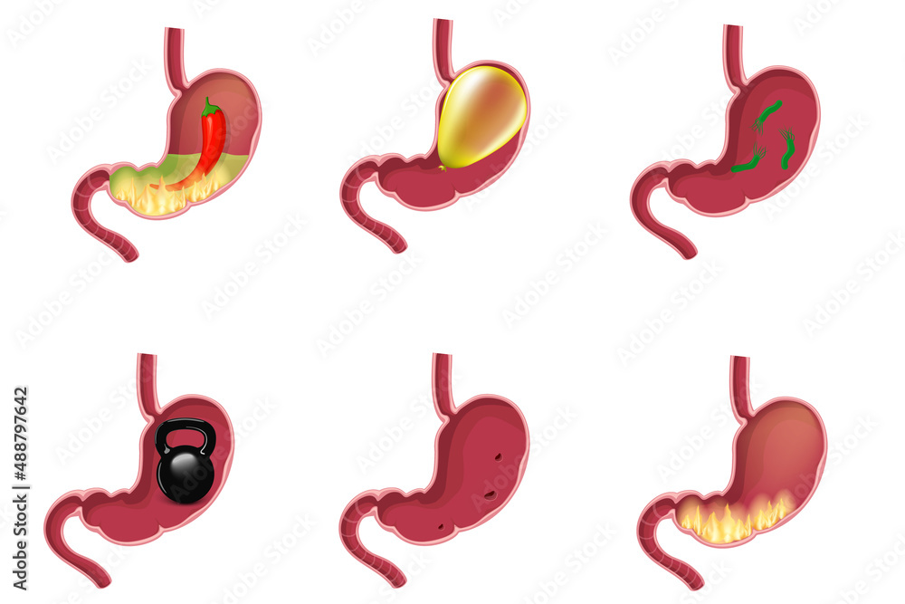 Healthy and unhealthy, empty and full human stomach in trendy flat ...