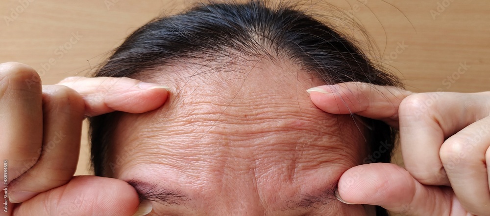 Portrait showing the headache, problem crease skin and skin weakness on ...