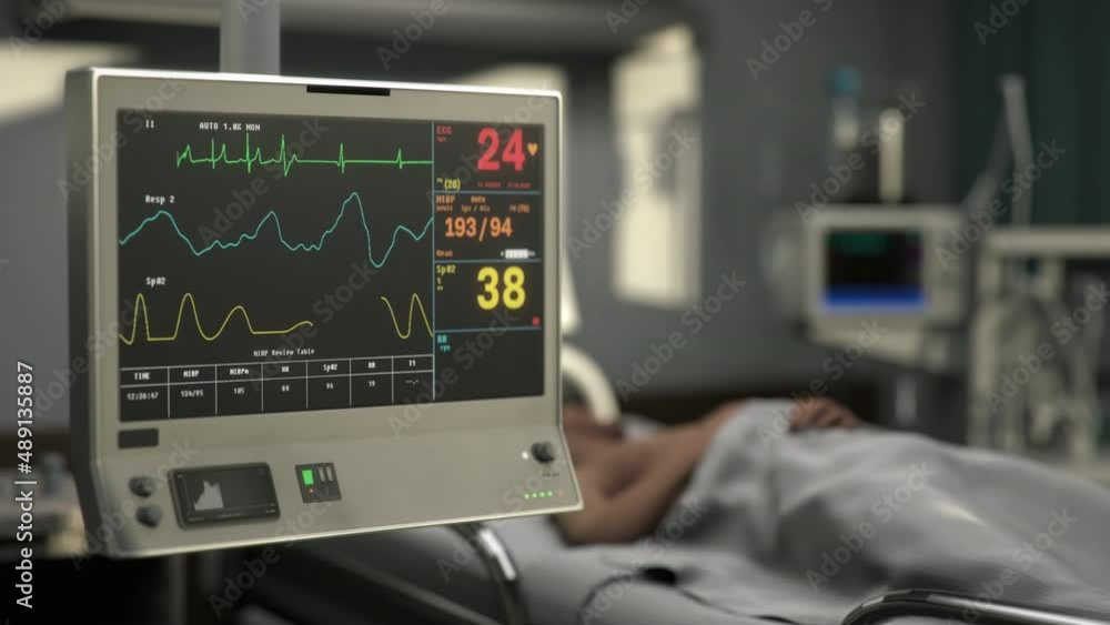 Modern monitoring device is showing the graphs of the patients pulse ...
