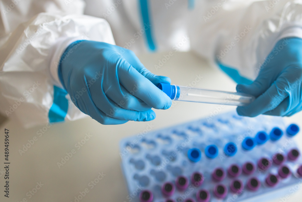 Process of coronavirus PCR antigen testing examination by nurse medic ...