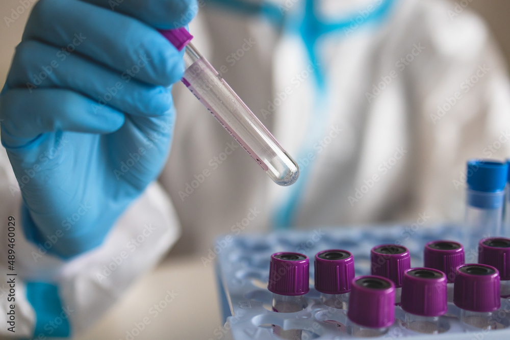 Process of coronavirus PCR antigen testing examination by nurse medic ...