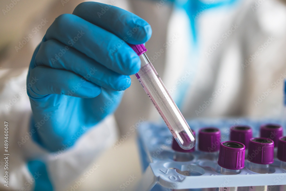 Process of coronavirus PCR antigen testing examination by nurse medic ...