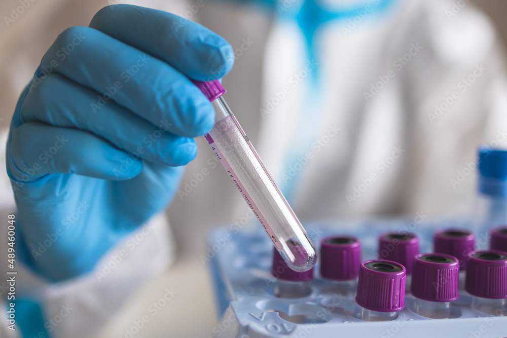 Process of coronavirus PCR antigen testing examination by nurse medic ...