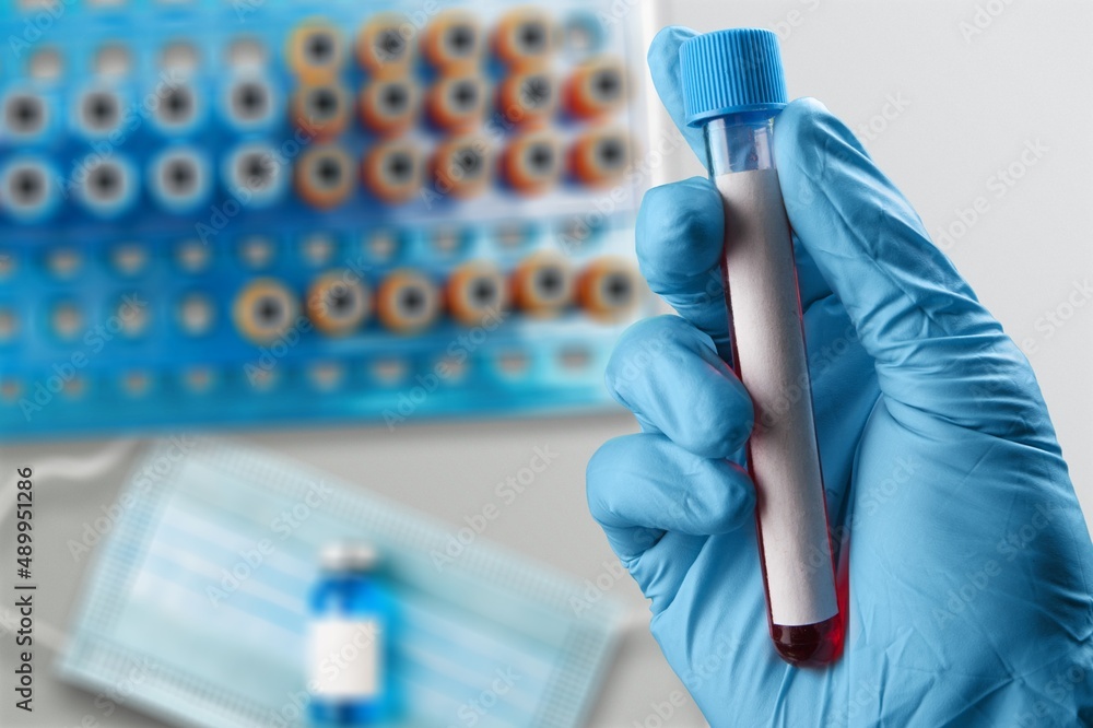 Blood sample for test with laboratory background. Stock Photo | Adobe Stock