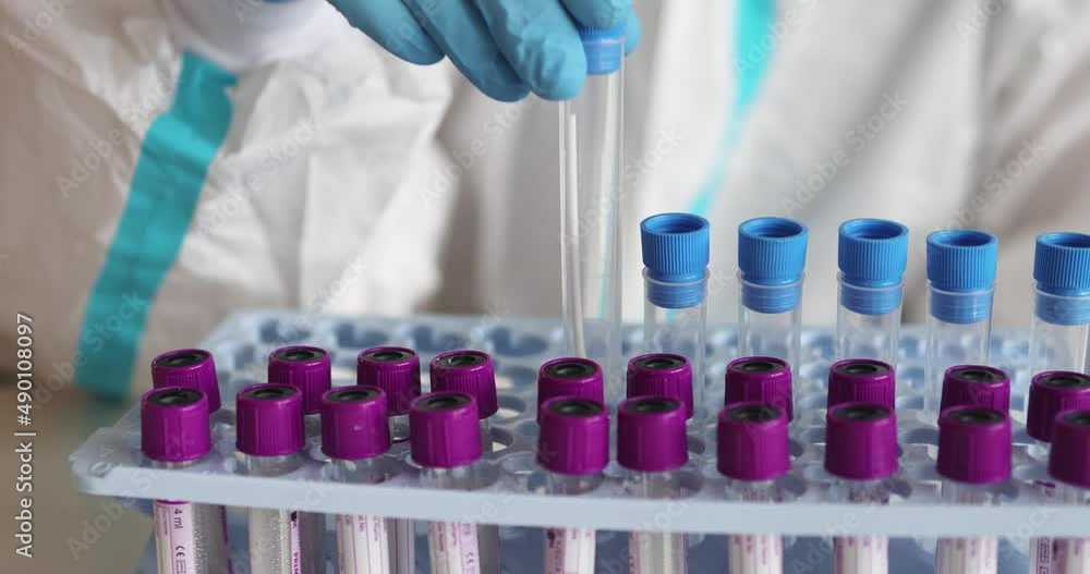 Process of coronavirus PCR antigen testing examination by nurse medic ...